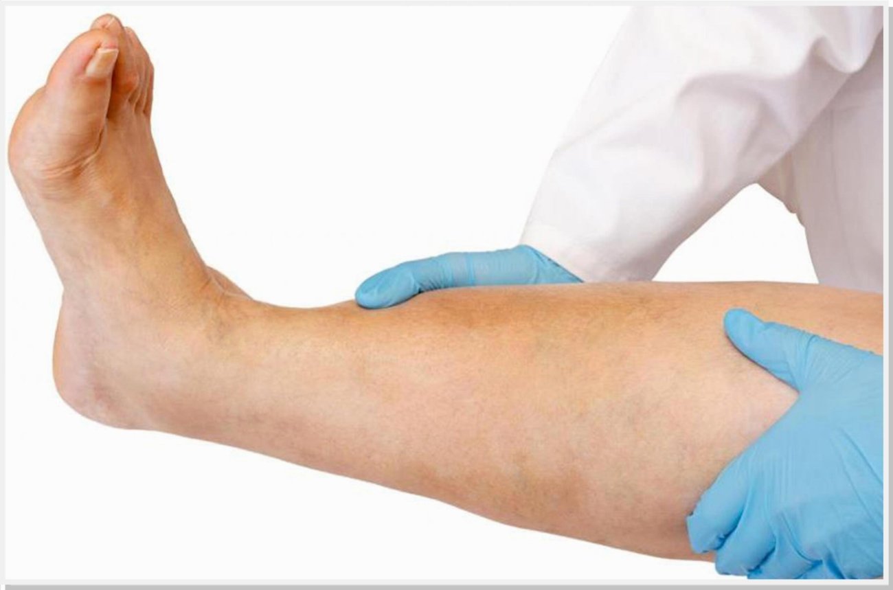 Arquivos inchaço nos pés - Cirurgião Vascular